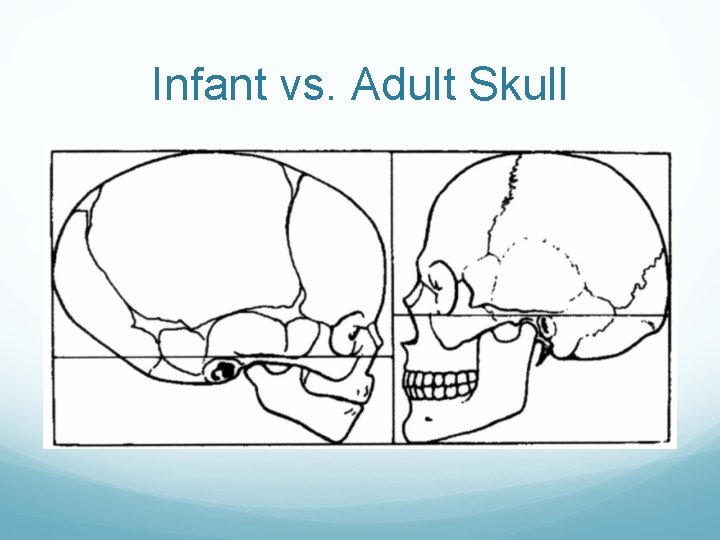 Age Race and Sex Determination from Bones Forensic