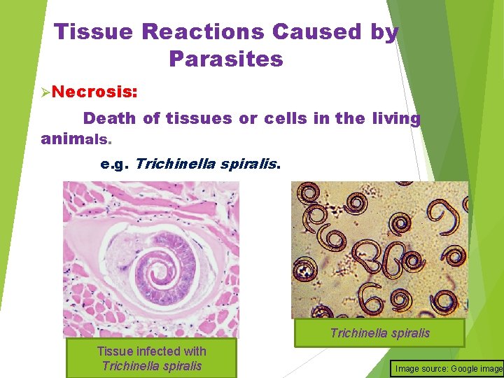 Tissue Reactions Caused By Parasites Dr AJIT KUMAR