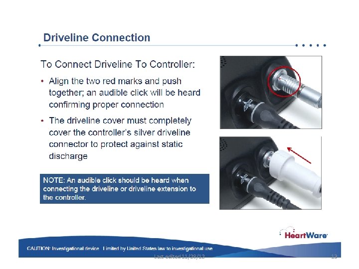 Heartware HVAD Ventricular Assist System Last edited 91213