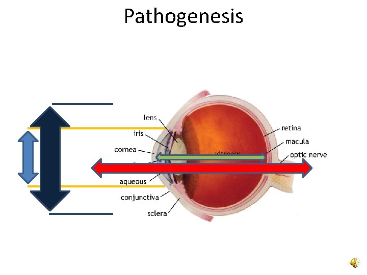 Congenital Developmental Glaucoma By Professor Nader Bayoumi MD