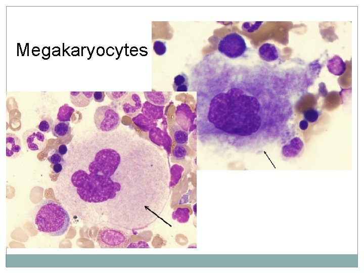 Thrombocytes and Coagulation VTHT 2323 CLINICAL PATHOLOGY KRISTIN