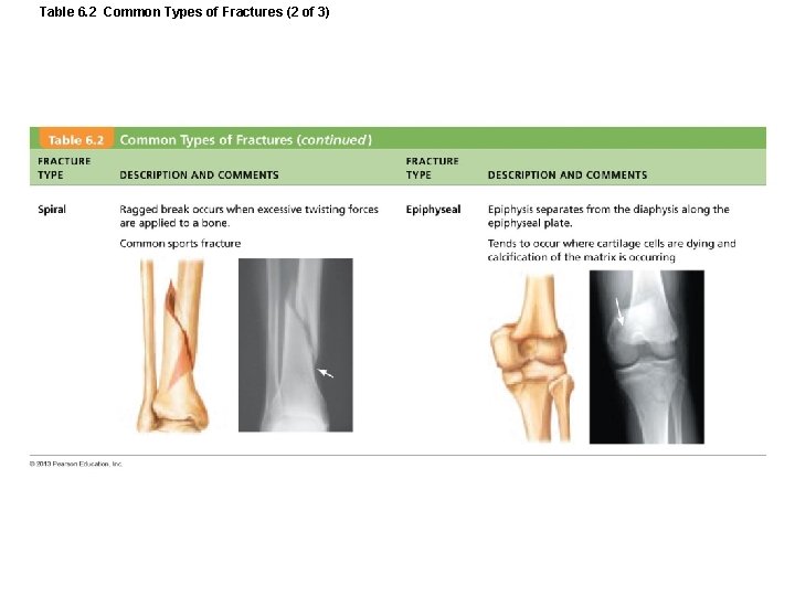Chapter Opener 6 Figure 6 1 The bones