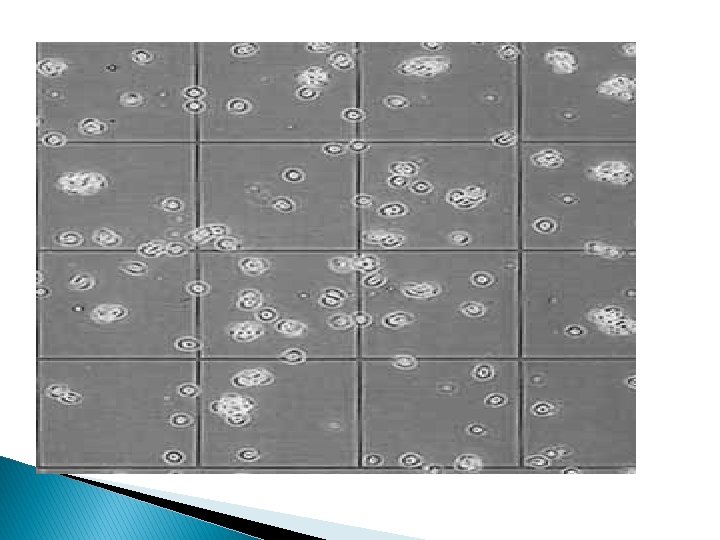 Microscope parts RBC counting Normal range Men 5