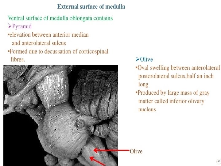 Brain stem Brain stem 1 Medulla oblongata 2