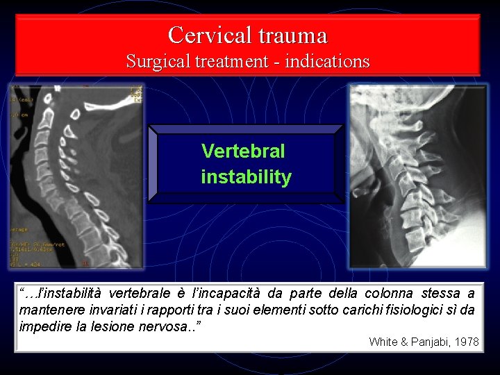 Instability criteria for cervical surgery The lower cervical