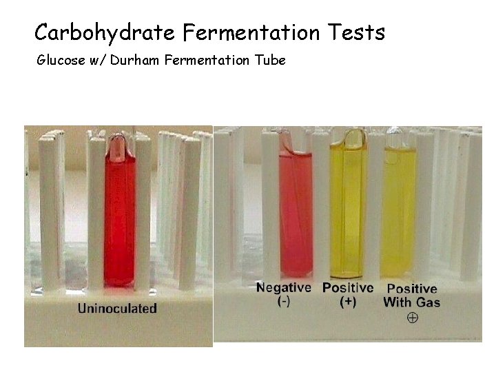 Lab Exercise 17 Biochemical Differentiation of some Medically