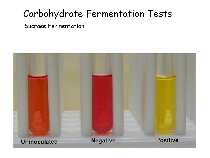 Lab Exercise 17 Biochemical Differentiation of some Medically
