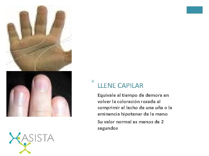 SIGNOS VITALES SIGNOS VITALES n Los signos vitales