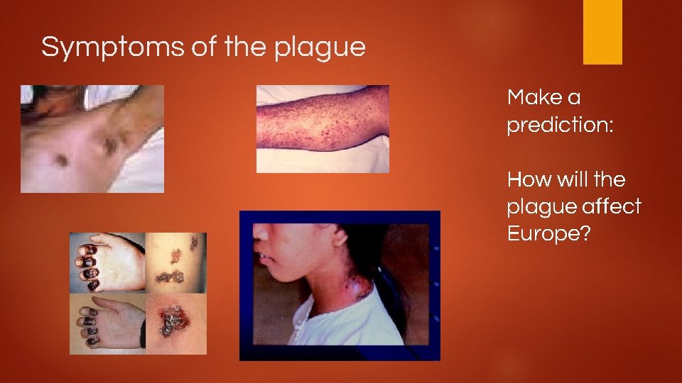 The Black Death Bell Ringer Introduction to the