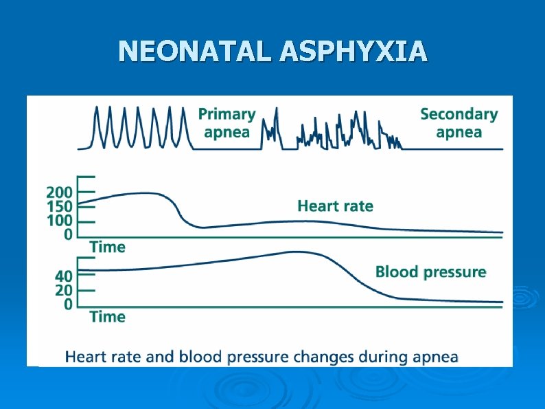 NEONATAL ASPHYXIA Prof Maria Stamatin MD Ph D