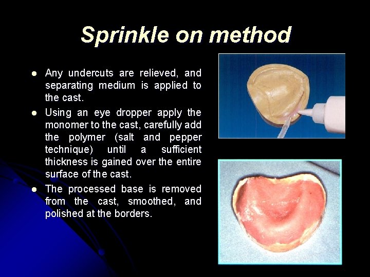 Record bases occlusion rims Record bases Definition l