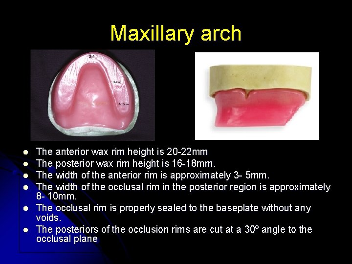 Record bases occlusion rims Record bases Definition l