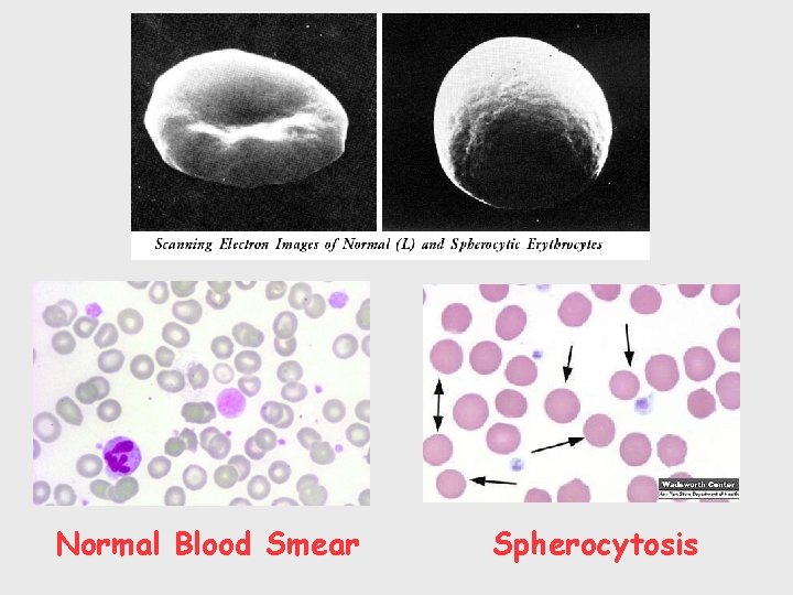 Objective 4 Erythrocytes A Functions Carry O 2