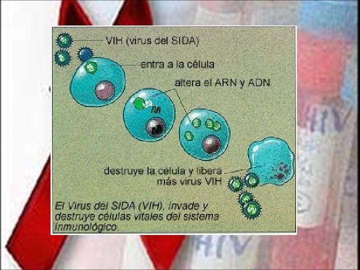 SIDA El SIDA o Sndrome de Inmunodeficiencia Adquirida