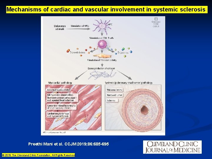 Mechanisms of cardiac and vascular involvement in systemic
