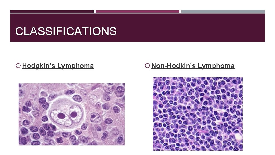 HODKINSNONHODGKINS LYMPHOMA BY BRITTNI MCCLELLAN CLASSIFICATIONS ...