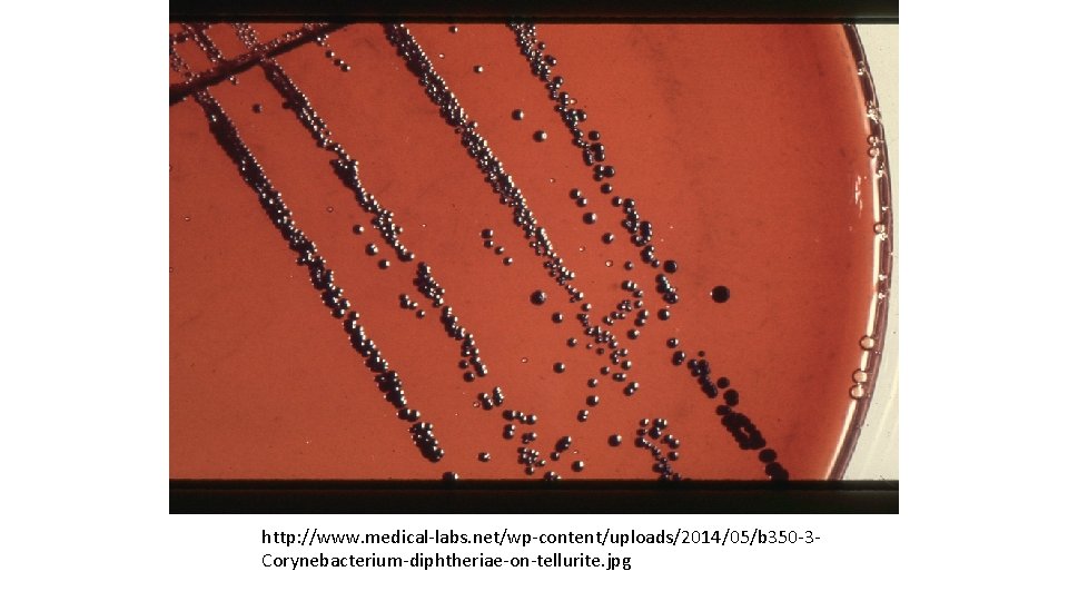 Bacterial infections of the respiratory system 3 By