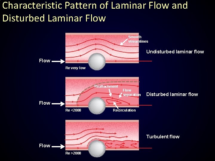 Vascular Restoration A Theoretical Advantage Between Bioabsorbable ...