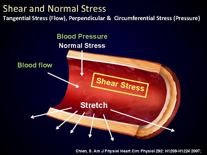 Vascular Restoration A Theoretical Advantage Between Bioabsorbable ...
