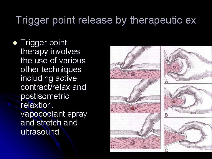 Rehabilitation of Neck Pain and Myofascial Pain Syndrome