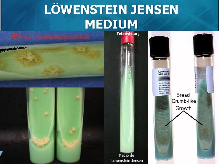 Bacteriological diagnosis of TB Microscopic examination n It