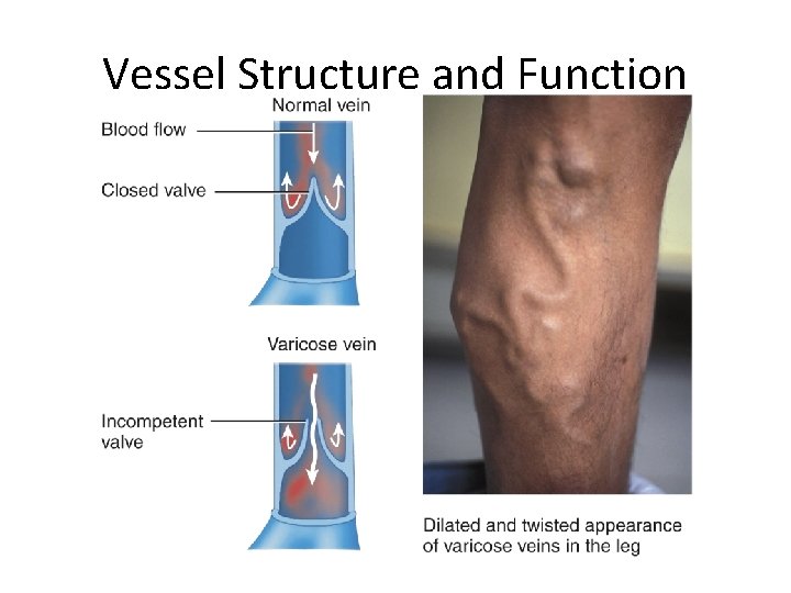 Vessel Structure and Function The terminal end of