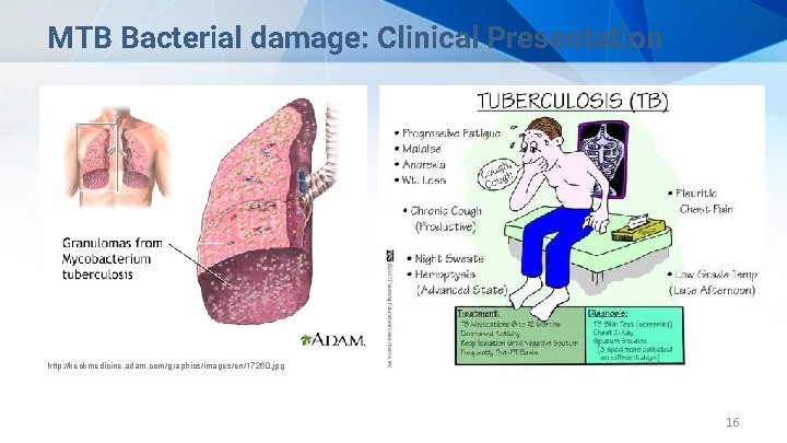 Bacterial Pathogenesis of Pulmonary Infection PATH 417 A