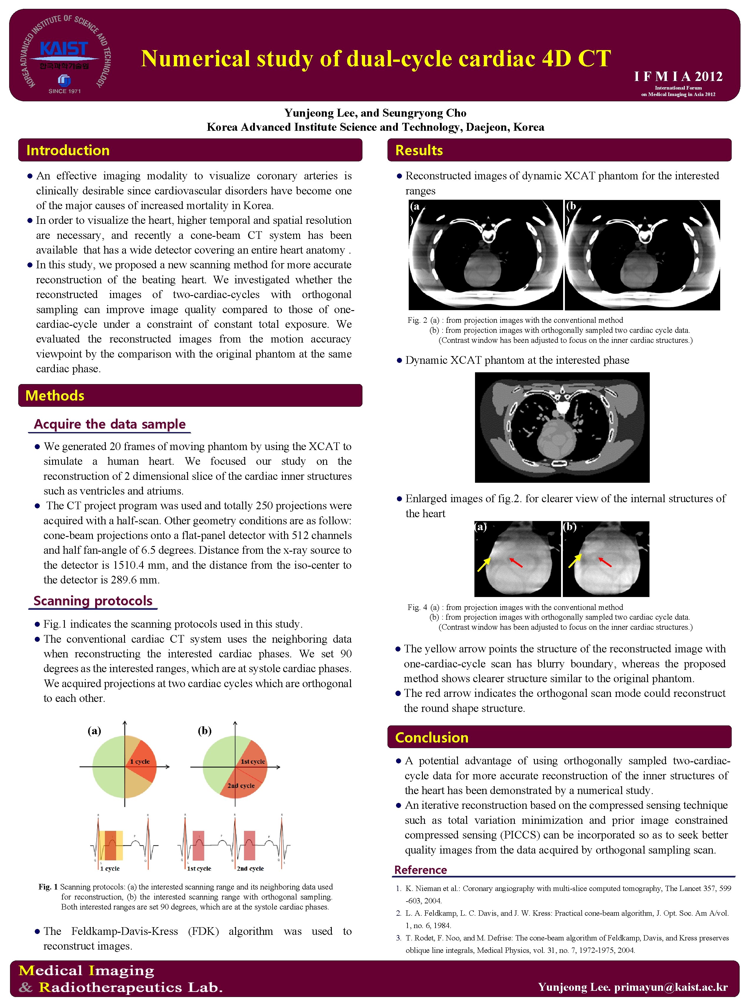 Numerical study of dualcycle cardiac 4 D CT