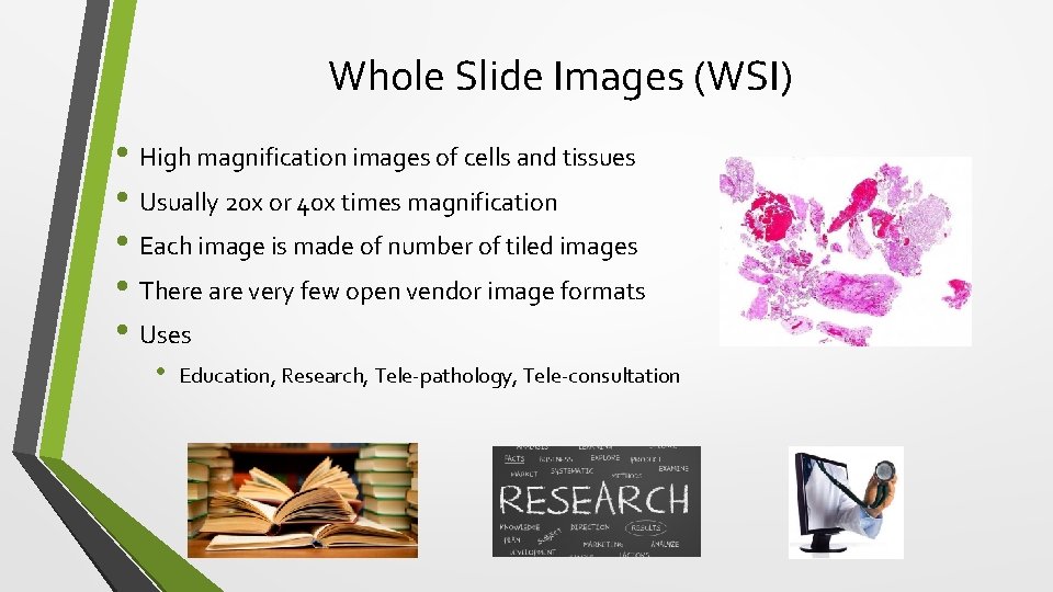 Whole Slide Image Stitching for Osteosarcoma detection Ovidiu