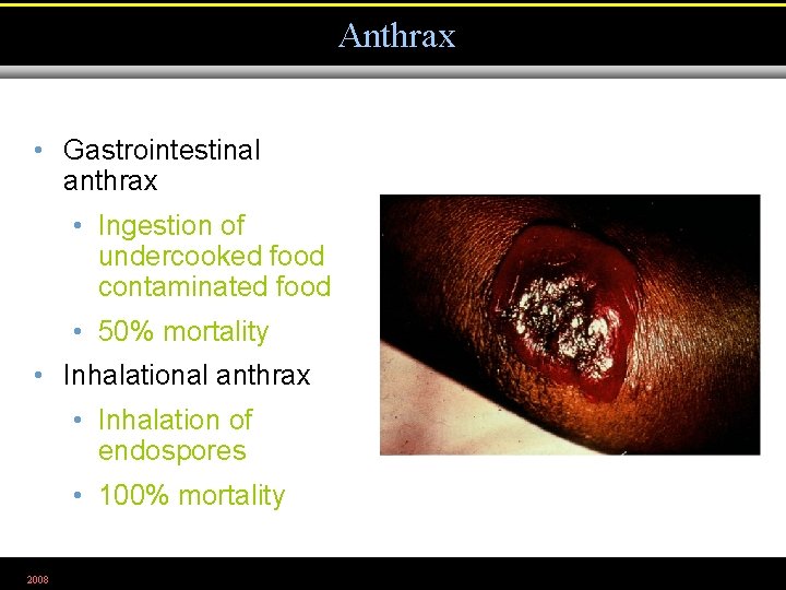 MICROBIOLOGY Chapter 23 Microbial Diseases of the Cardiovascular