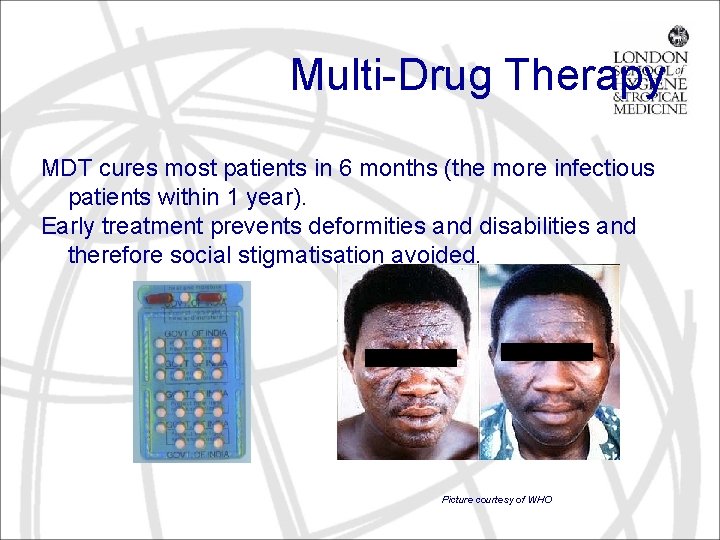 Overview of leprosy Sara Atkinson worldwide distribution of