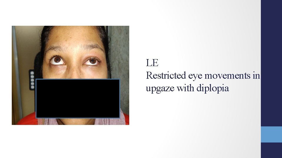 AN UNUSUAL CASE OF ORBITAL CYSTICERCOSIS Dr Chaitali