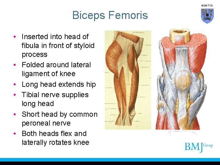 MOB TCD Posterior Compartment of Thigh Professor Emeritus