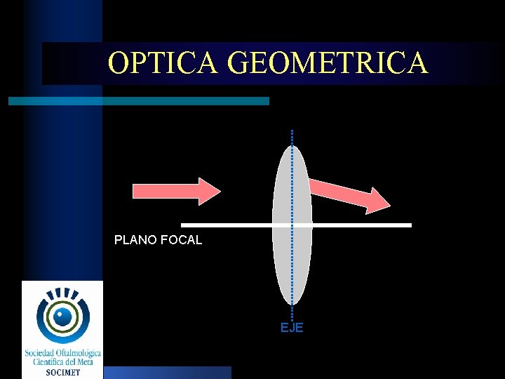 TRASTORNOS REFRACTIVOS ALEXANDER OSPINO ACEVEDO MEDICO Y OFTALMOLOGO