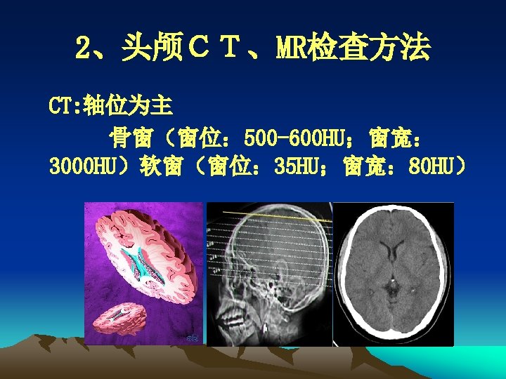 Brain and spinal cord Normal Appearance of Head