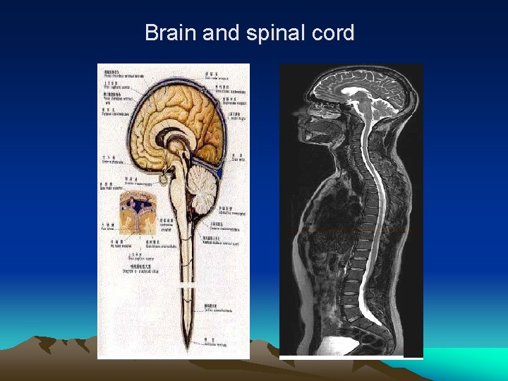 Brain and spinal cord Normal Appearance of Head