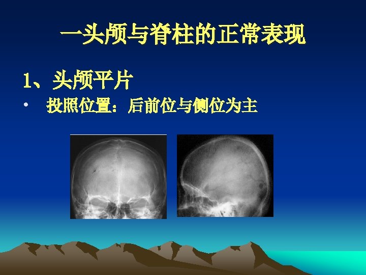 Brain and spinal cord Normal Appearance of Head