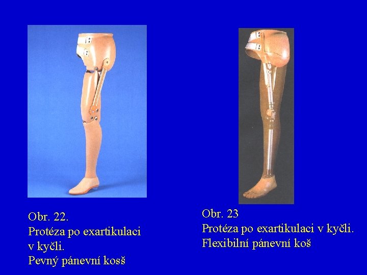 Protetika I ortopedick klinika LF MU v Brn