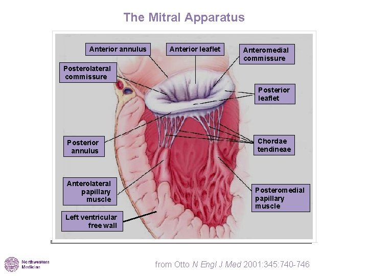 Mitral Regurgitation Epidemiology Pathophysiology and When to Repair