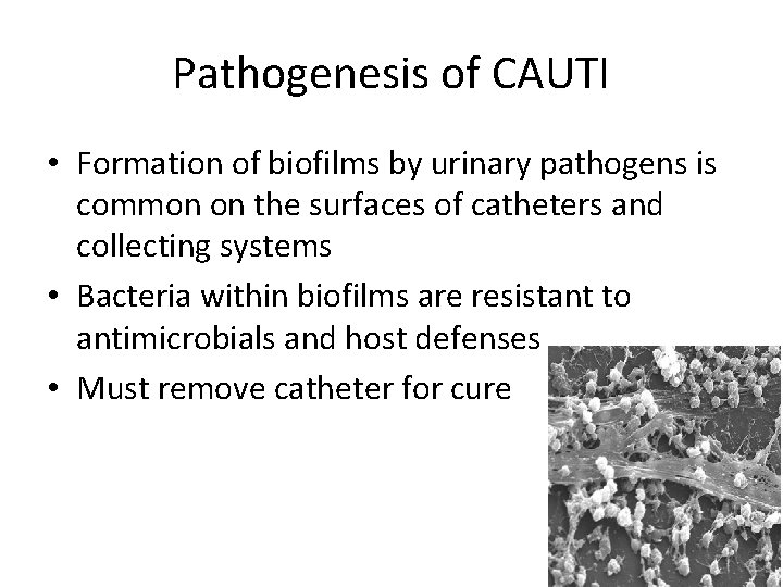 Hospital Acquired Infections HAI DR MAZIN BARRY MD