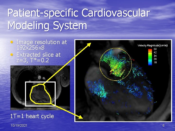 Patientspecific Cardiovascular Modeling System using Immersed Boundary ...