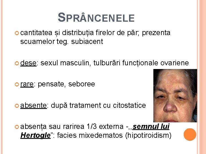 SEMIOLOGIA OCHILOR Dr Cristina Sabo ANAMNEZA Cum stati