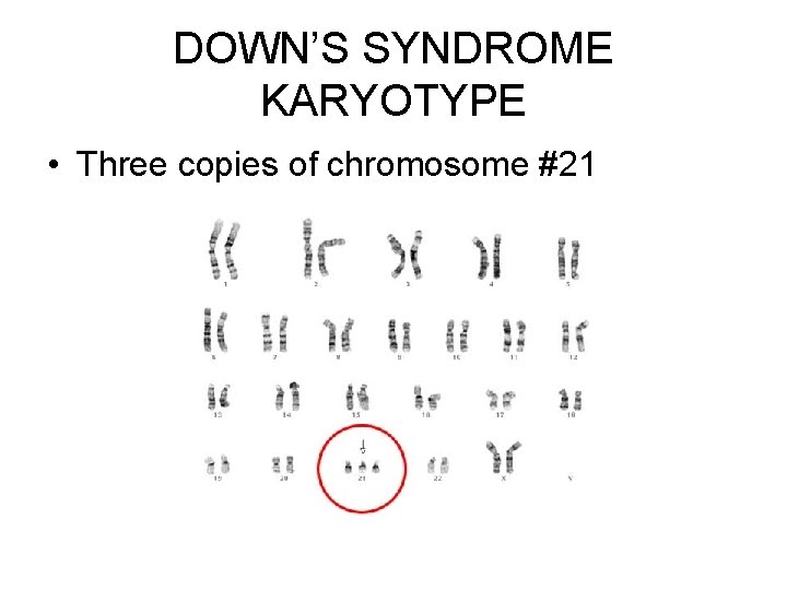 Karyotypes A picture of a persons chromosomes Karyotype