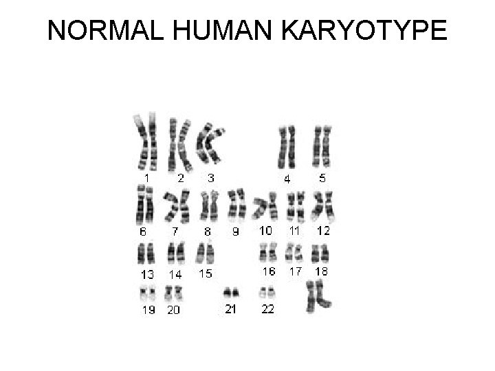 Karyotypes A picture of a persons chromosomes Karyotype
