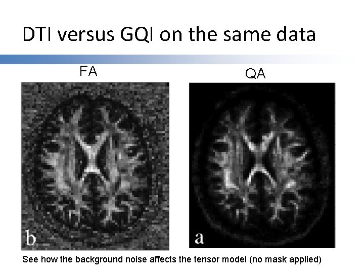 DTI versus GQI DTI GQI fibers diffusion observed