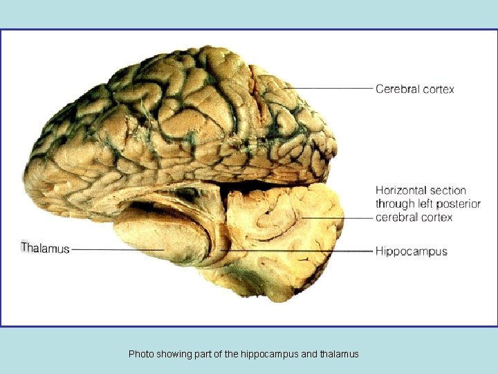 NEUROPSYCHOLOGY Brain Structure Function and Cerebral Dominance Dr