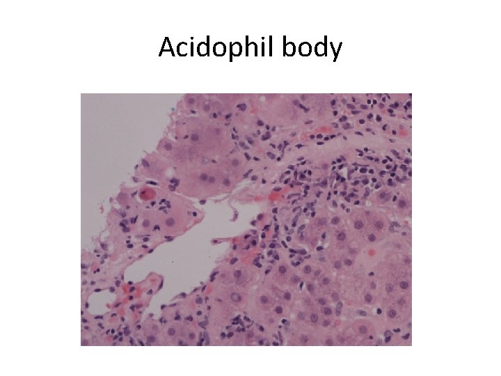 Liver Pathology Made Easy and Understandable II Patterns