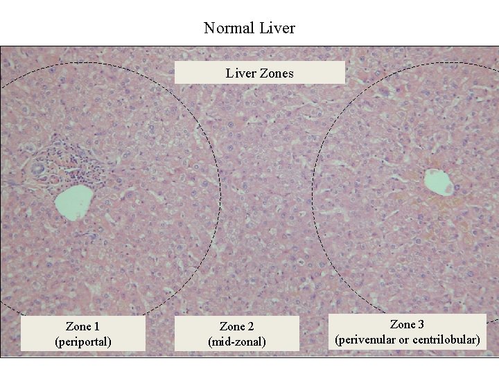 Liver Pathology Made Easy and Understandable II Patterns