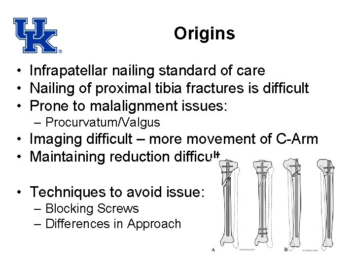 The SupraPatellar Approach 5 Reasons You Should Consider
