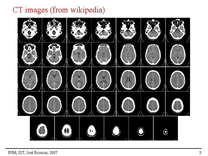 XRay Computed Tomography Radon Transform Fourier Slice Theorem